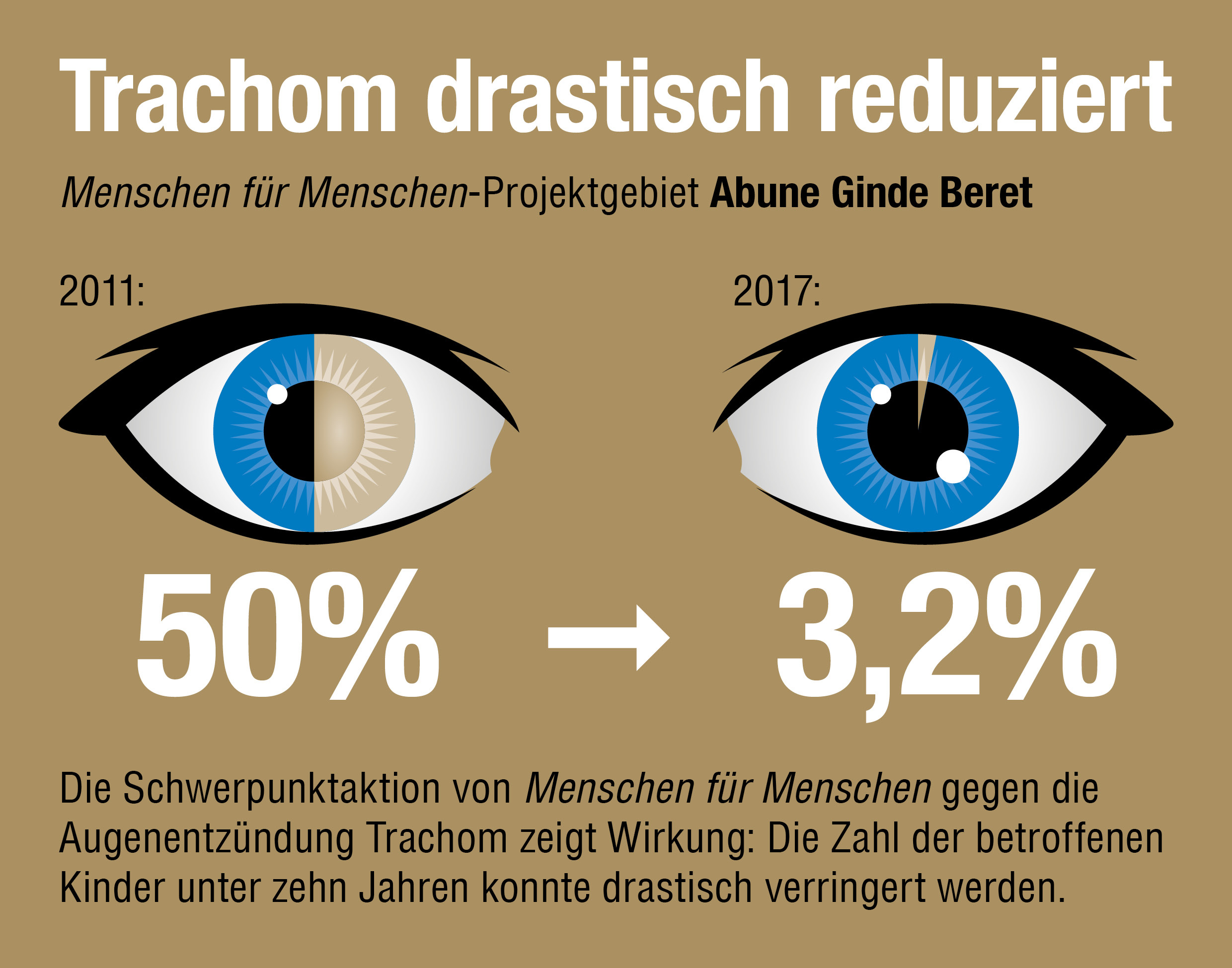 Auge in Auge gegen Erblindung | Projektgeschichten Äthiopien | Menschen ...